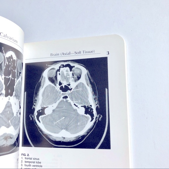 Accents | Pocket Atlas Of Normal Ct Anatomy Head Brain Book 2nd Edition ...